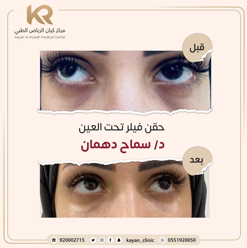Home - Kayan Riyadh Medical Center