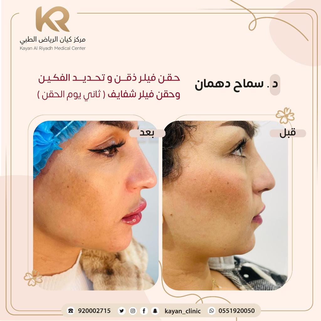 Home - Kayan Riyadh Medical Center