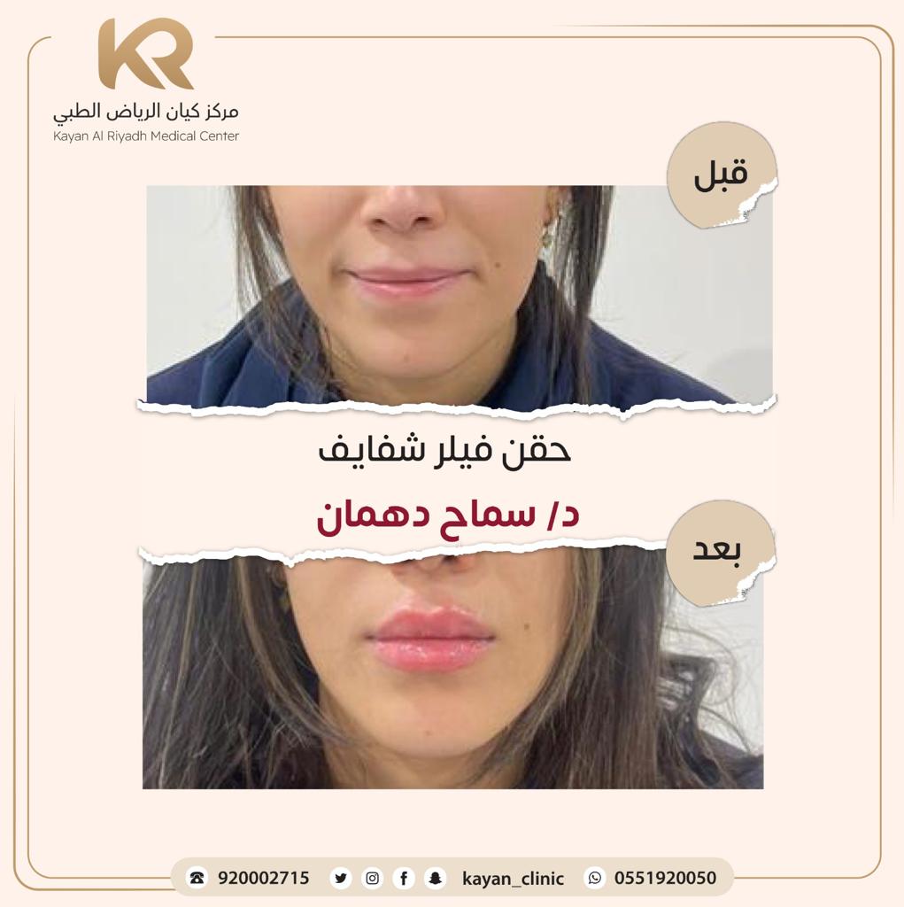 Home - Kayan Riyadh Medical Center